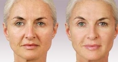 Exercising The Face For Skin Revitilization And Youth Retention ...