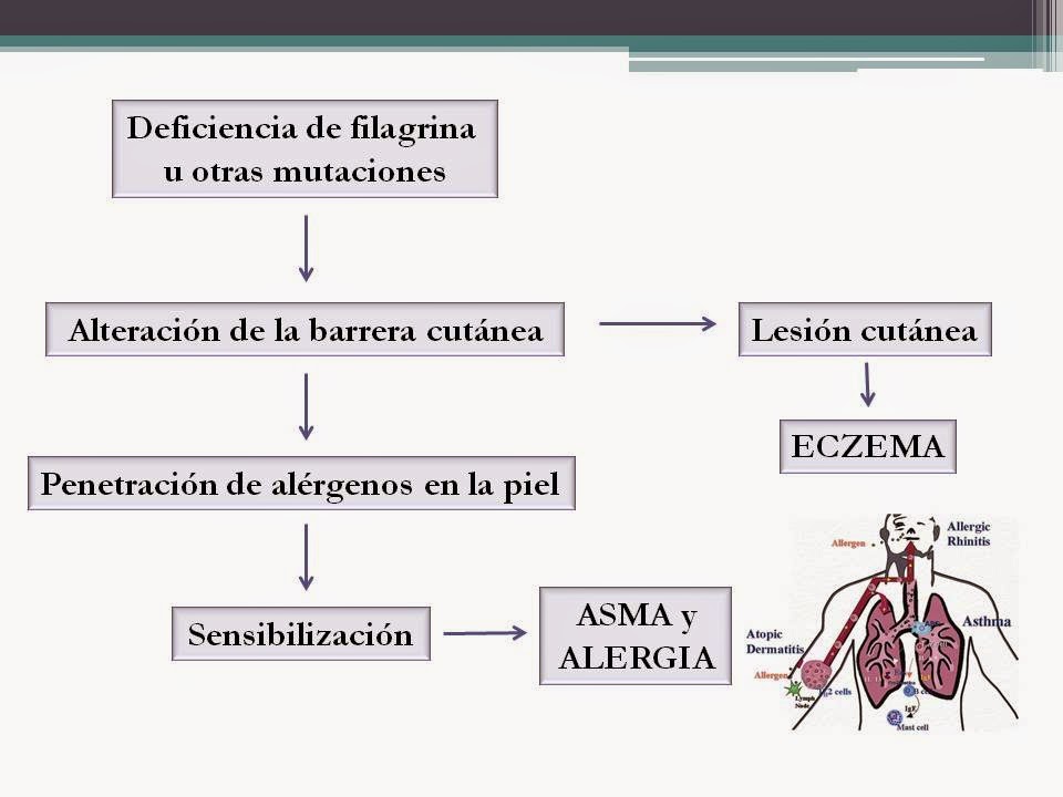 Dermatología en la Costa del Sol: Actualización en Dermatitis Atópica ...