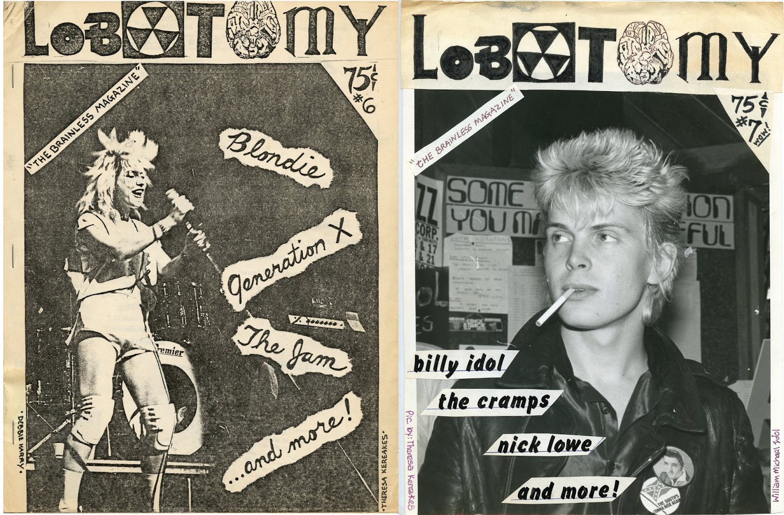 A Brief History of Lobotomy the Brainless Magazine