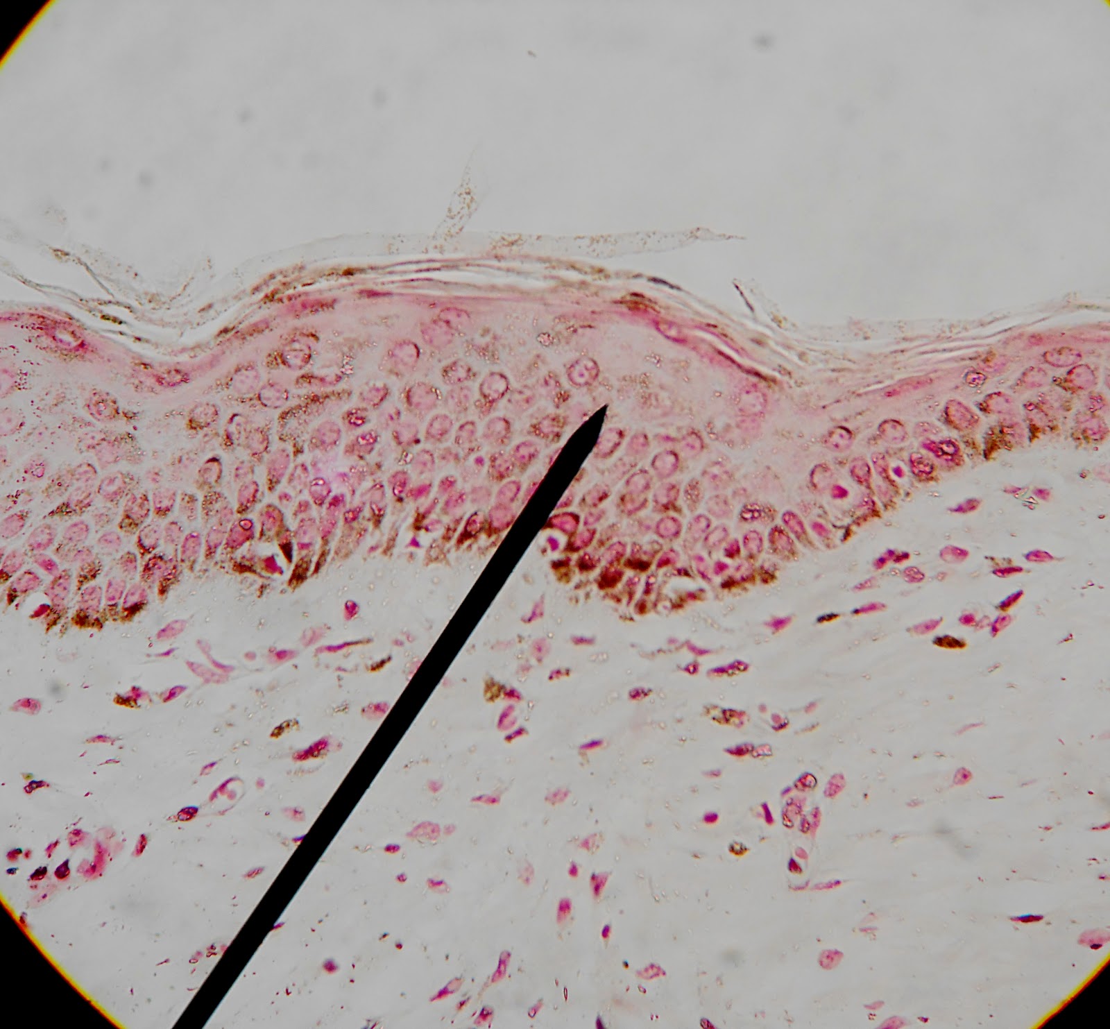 Placas Histologicas : Piel