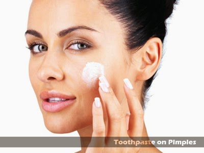 Can Toothpaste on Pimples Really Help? | Hormonal Acne Tips