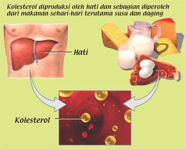 Penyakit Kolesterol dan Cara Pengobatannya: PENYAKIT KOLESTEROL DAN ...