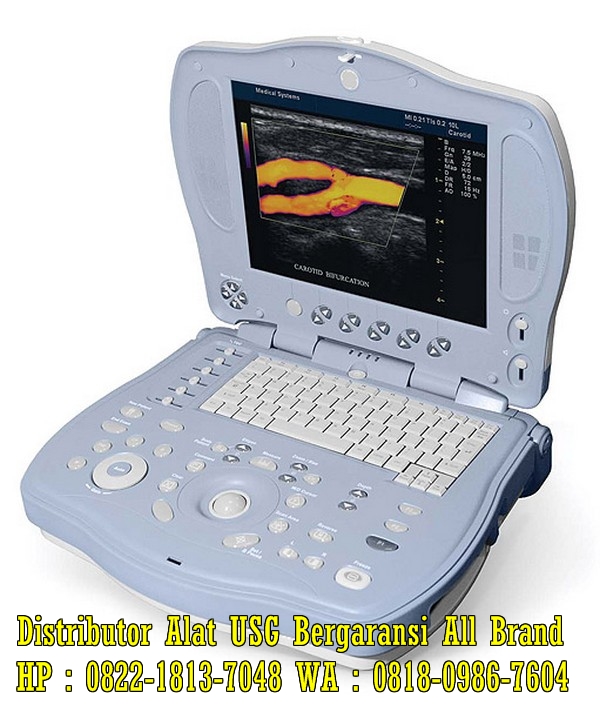 Science Archive: Distributor Alat USG Mindray dan Weld