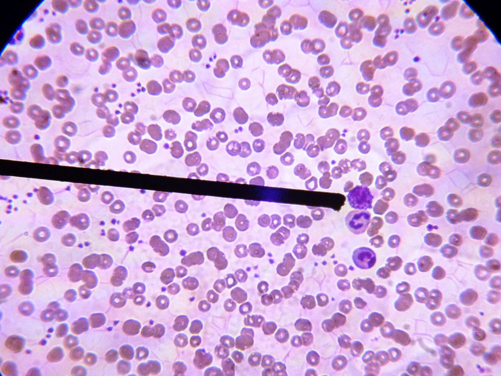 Ula Medicina 2012: Histologia Tema 20 Tejido Sanguíneo