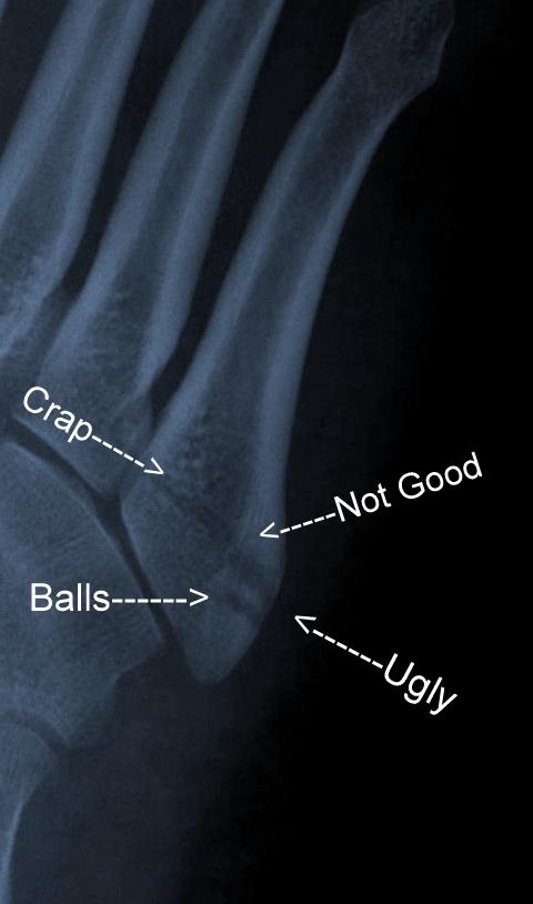 Good Foot, Bad Foot, Sad Foot, Crap Foot