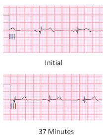 Dr. Smith's ECG Blog: May 2013