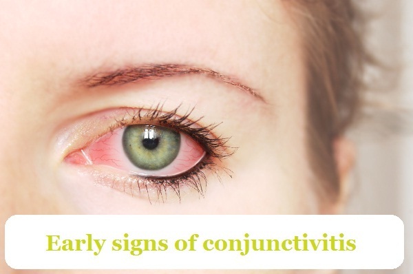 Early Signs of Conjunctivitis - Health Blog - Explore Content About ...