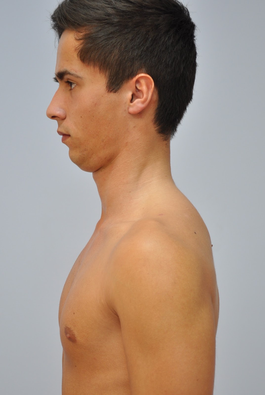 Fisioinforma: Distensão traumática da coluna cervical