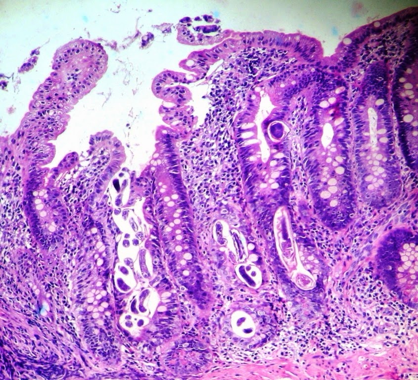 GASTROINTESTINAL AND LIVER HISTOLOGY PATHOLOGY ATLAS: DUODENUM ...