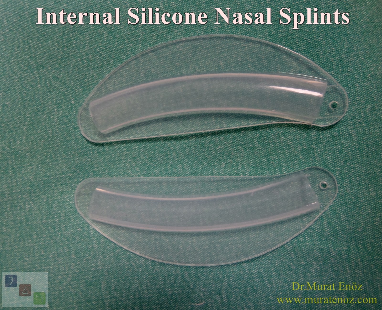 Health Zone Turkey: Frequently Asked Questions (FAQ) About Rhinoplasty ...