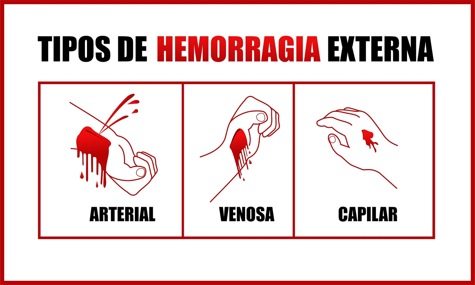 6 acciones para salvar una vida: 2.Hemorragias