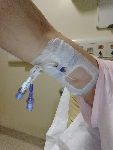 Sarah's Lymphoma Experience: PICC line and R-CHOP Chemotherapy
