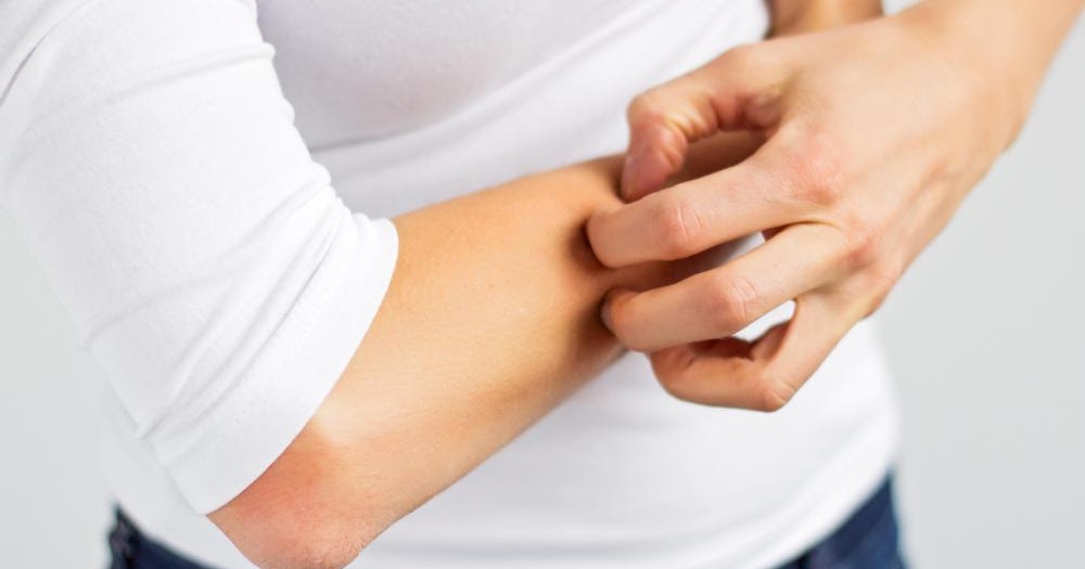 Itchy Scratchy Skin No More!