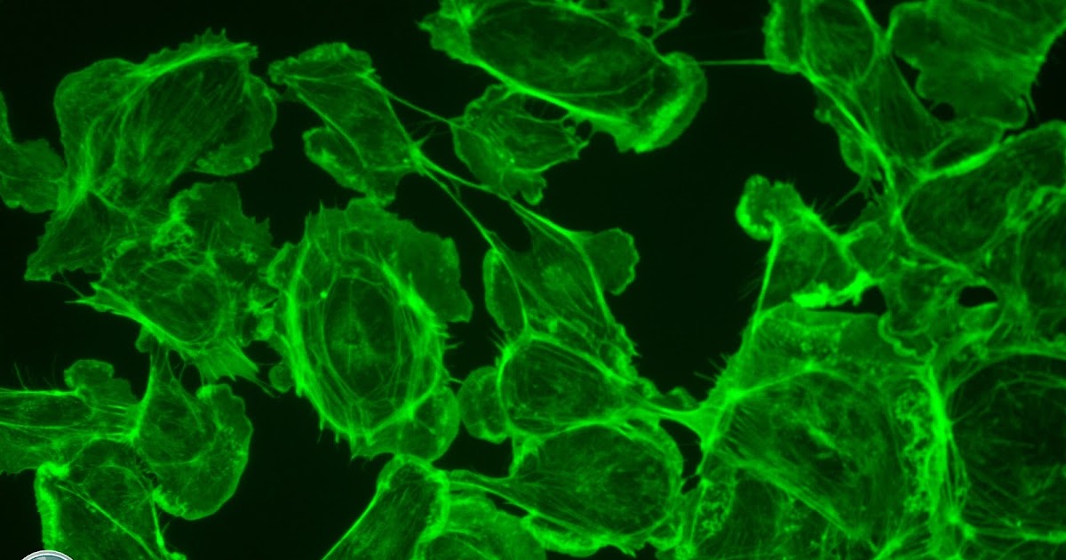 Microscope World Blog: Fluorescence Microscopy Microscope World Blog: Fluorescence Microscopy