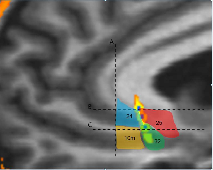 The Neurocritic: February 2013