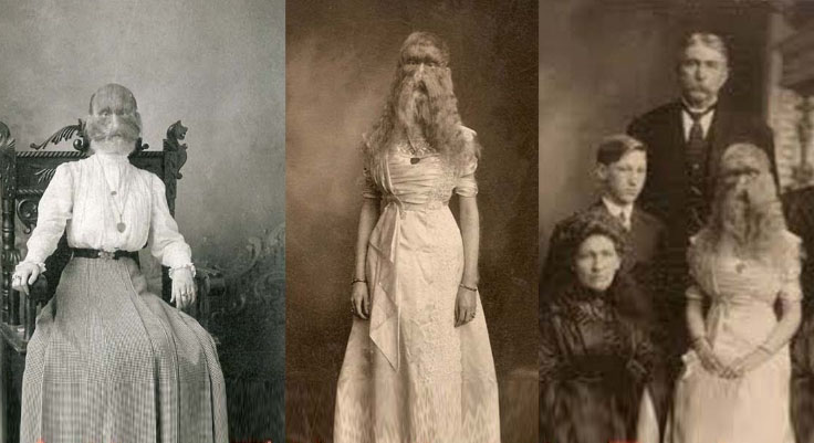 Alice Elizabeth Doherty - The Minnesota Wooly Girl