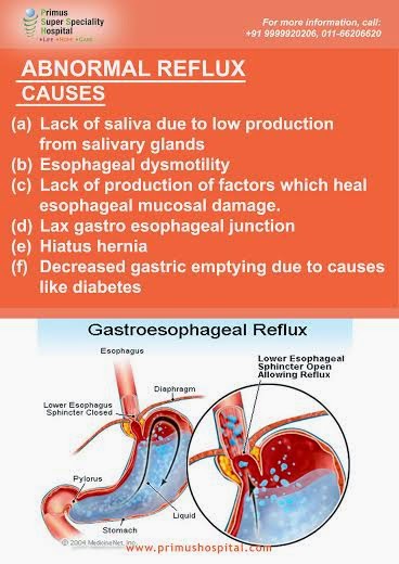 Gastro Esophageal reflux disease and current Understanding of ...