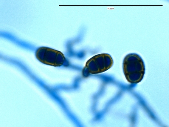 Fun With Microbiology (What's Buggin' You?): July 2015