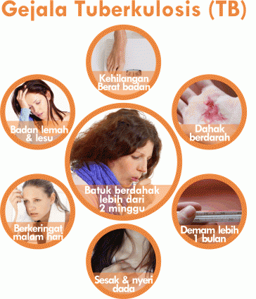 Ciri-Ciri Batuk TBC yang Menular | Ciri - Ciri Penyakitmu