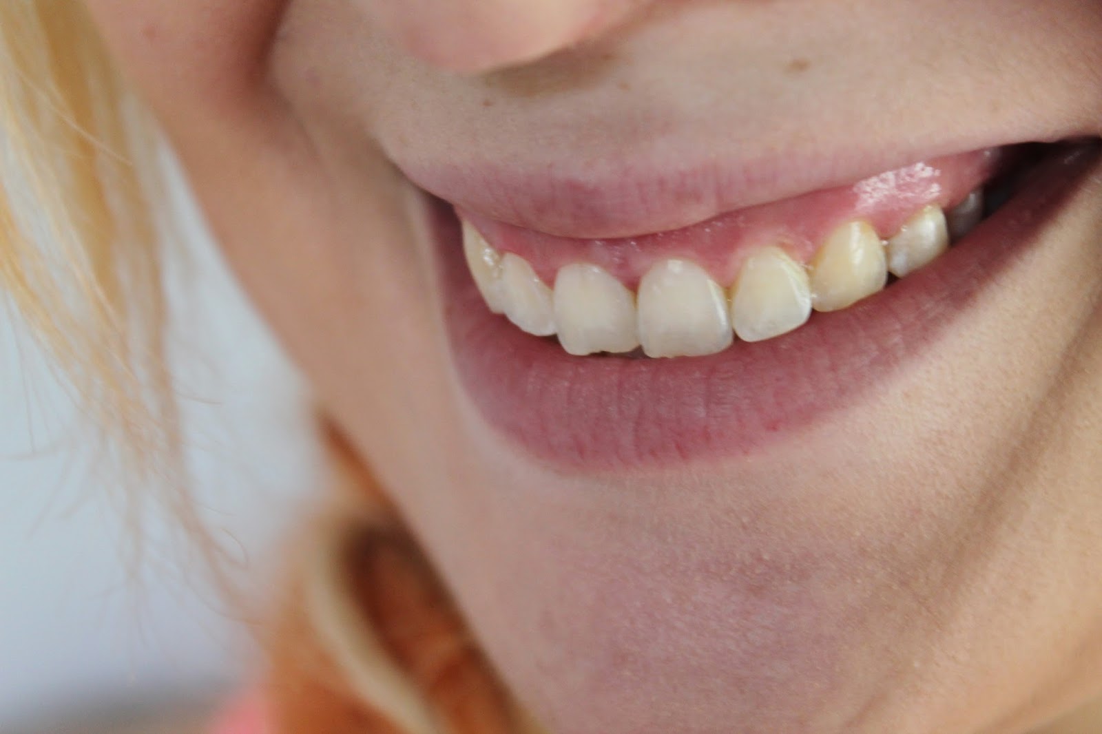 Smile Brilliant - Monica Hayworth