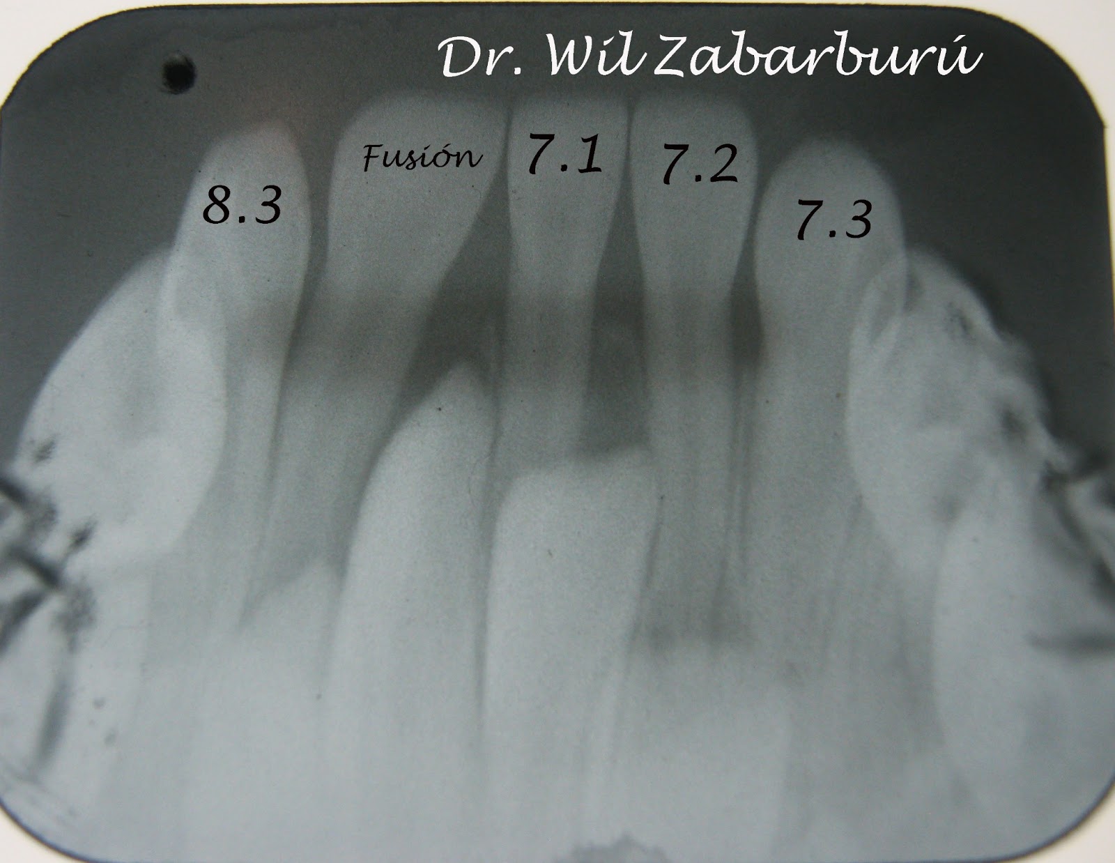 CLINICA DENTAL ASISTENCIAL: FUSIÓN DENTAL