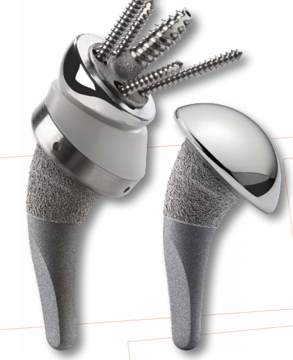 Shoulder Arthritis / Rotator Cuff Tears / Shoulder Pain : Short humeral ...