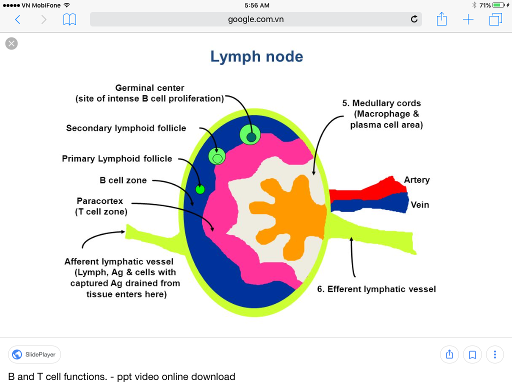 VIETNAMESE MEDIC ULTRASOUND: CASE 469: T CELL LYMPHOMA OF SUBMANDIBULAR ...