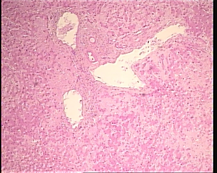 Said by Vann: T.P. Anapath Images 4 ème année en Médecine