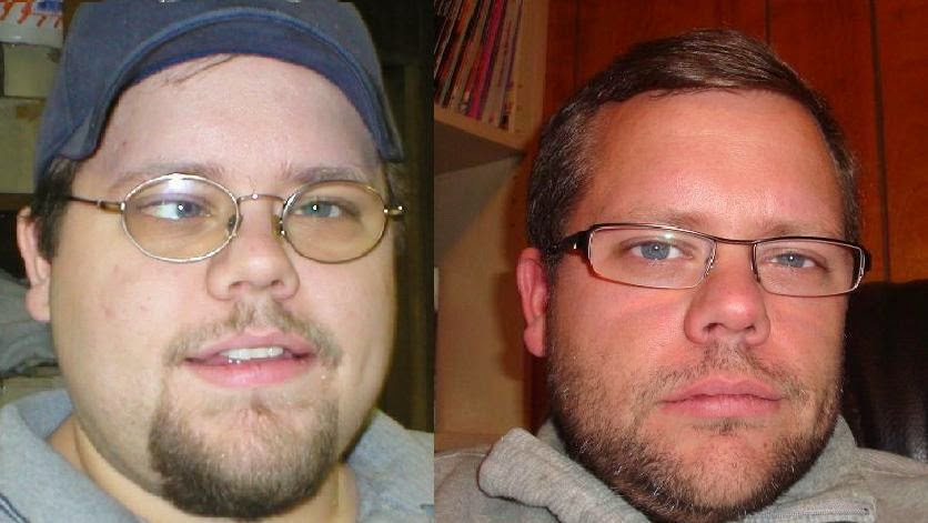 Medical Treatment Pictures-for Better Understanding: Strabismus Surgery ...