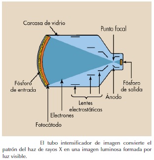 Instrumentacion: EQUIPO DE FLUOROSCOPIA