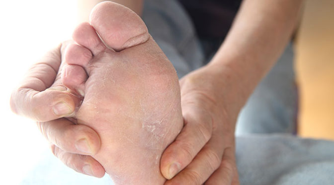 Cure Itchy Toes With Best Natural Ways | ToeNail Fungus Treatment