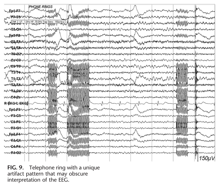 The Neurocritic: Newly Discovered EEG Rhythm Related to Texting, or ...