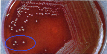 La gélose au sang :principe, composition et lecture... ~ ProBiologiste