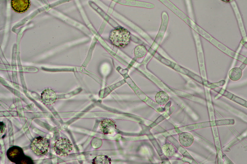 El mundo microscópico de los hongos: Hypomyces chrysospermus (Bull)Tul
