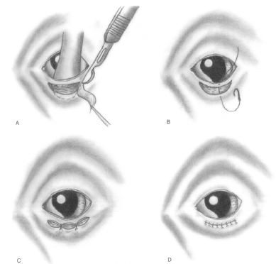 Teknik Operasi Entropion Dan Ectropion pada Hewan (Bedah Mata ...