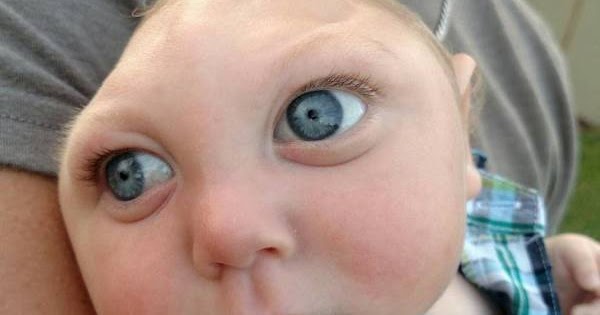 See Here: This Baby Was Born With An Unusual Head Shape ~ Entertainment ...
