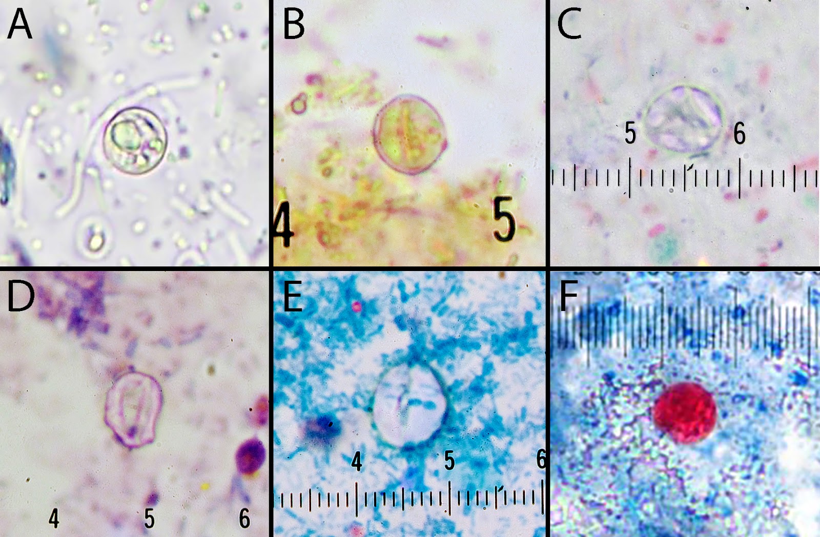 Creepy Dreadful Wonderful Parasites