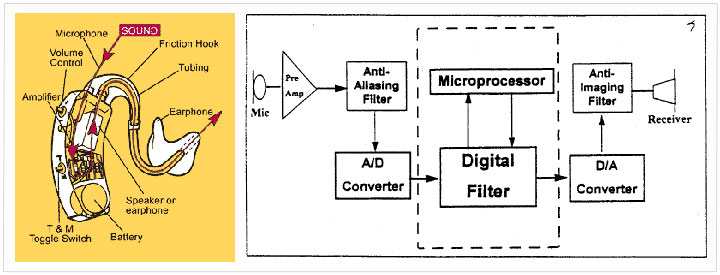 Hearing Aids And Types ~ Sound Well India
