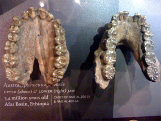 Horsing Around At Home: Wisdom teeth.......