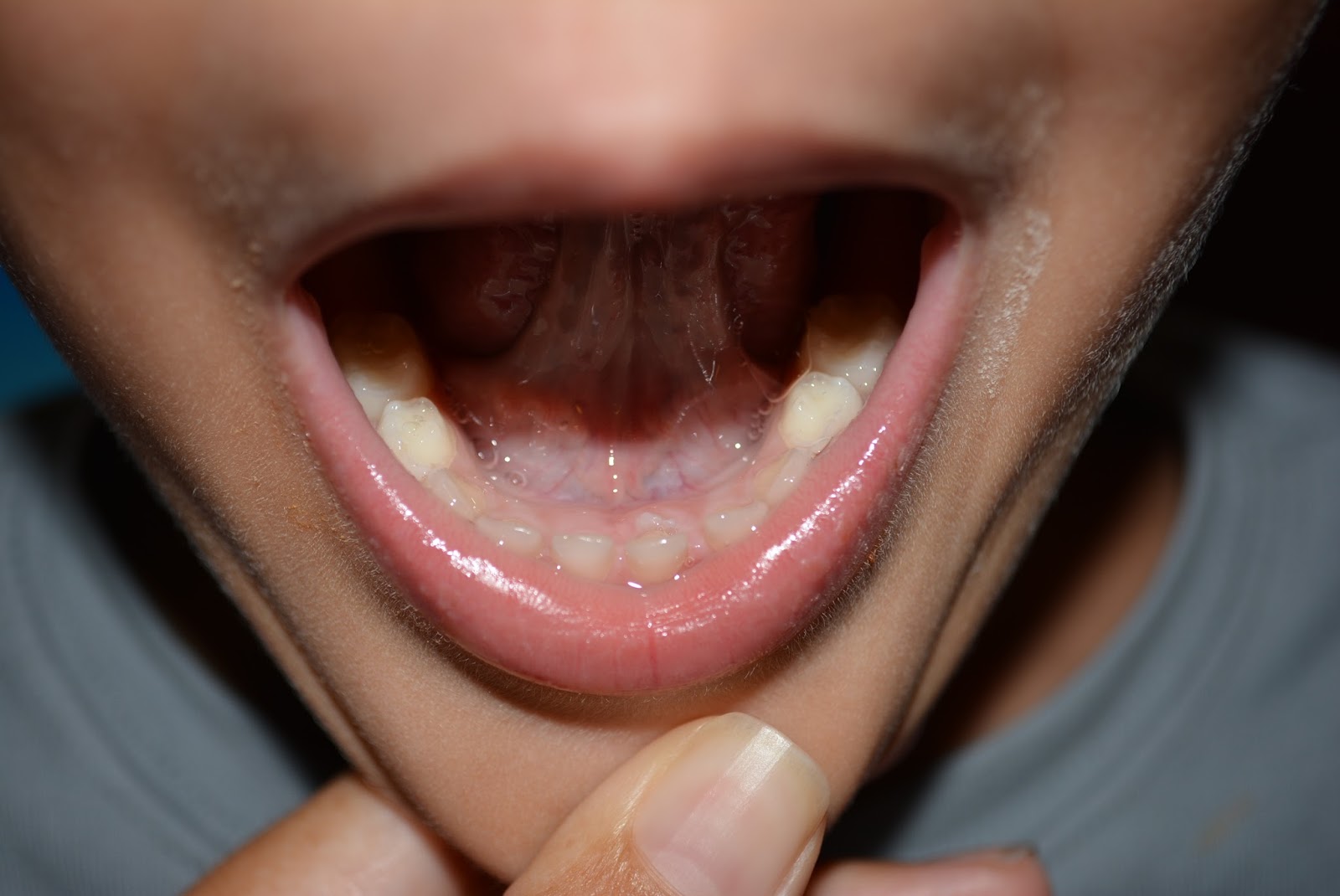 This Writer's Block: First loose tooth!