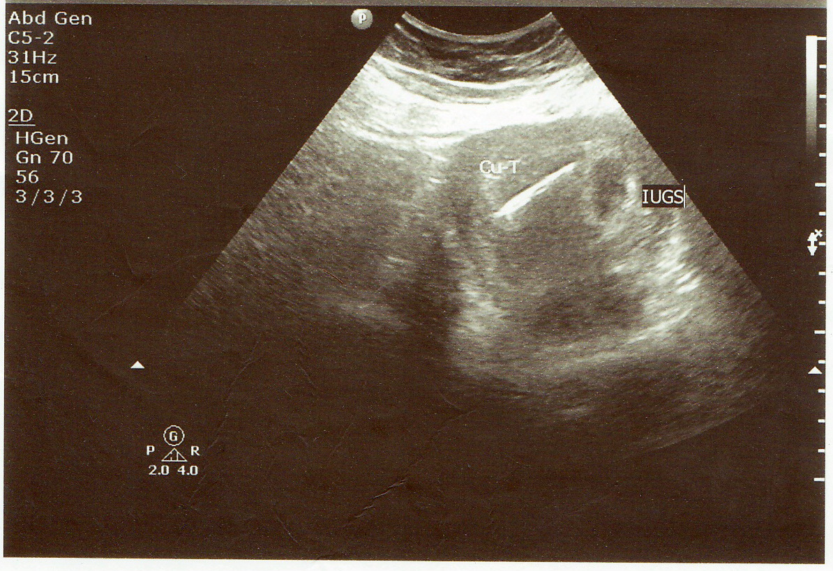 Ultimate Radiology : March 2013