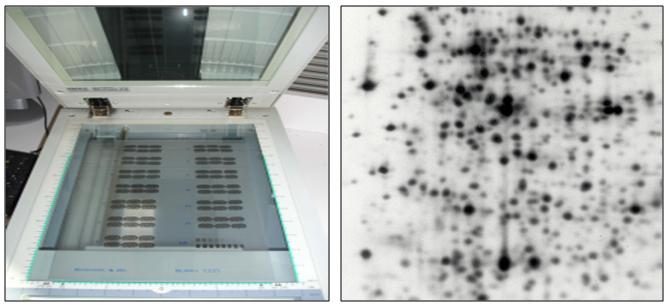Autoradiography in Chromatography