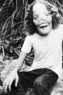 JANE ENTRE LINHAS: Roy Lee "Rocky" Dennis