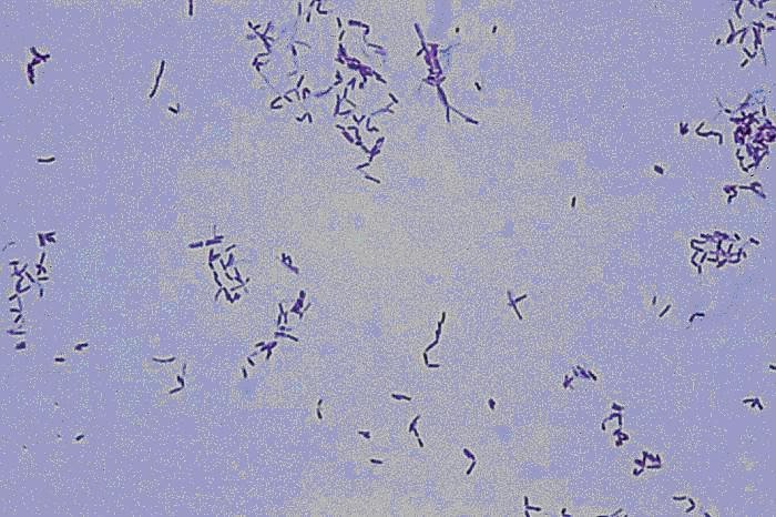 Mycobacterium Fortuitum