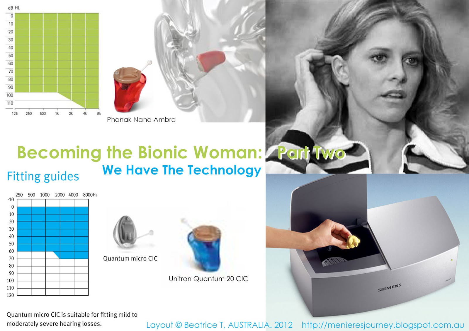 Menieres: An Inner (Ear) Journey: Becoming the Bionic Woman – Part Two