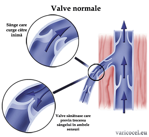 Varicocel: Informații varicocel | Informații despre varicocel