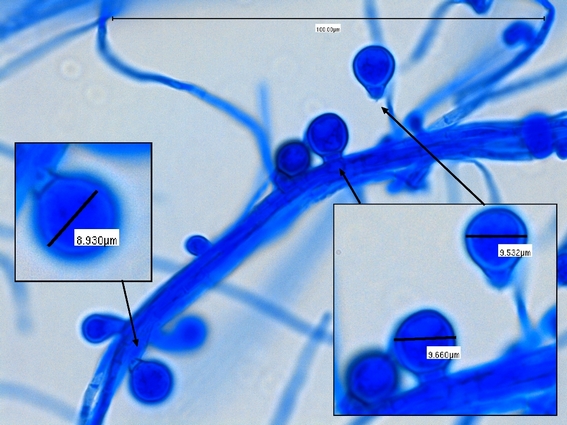 Fun With Microbiology (What's Buggin' You?): 2015
