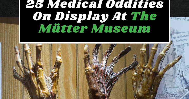 25 Medical Oddities On Display At The Mütter Museum