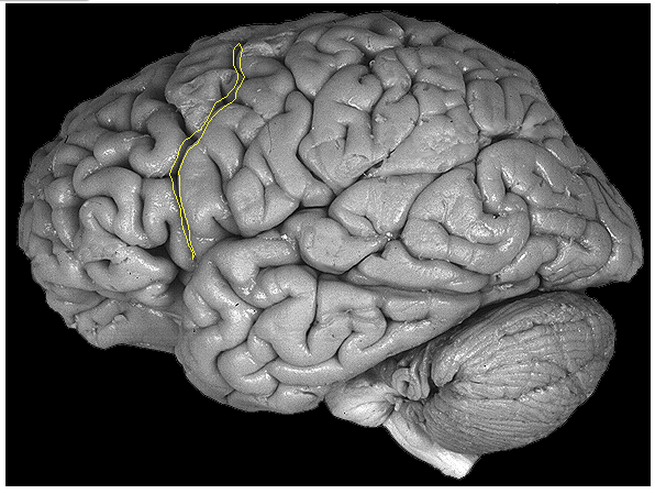 Atlas de neuroanatomía: FISURAS, SURCOS Y GIROS