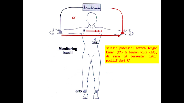 SAYANGI JANTUNG KITA: SADAPAN ECG, EKG